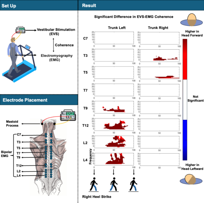 The effect of head orientation on vestibular signal-based modulation of ...