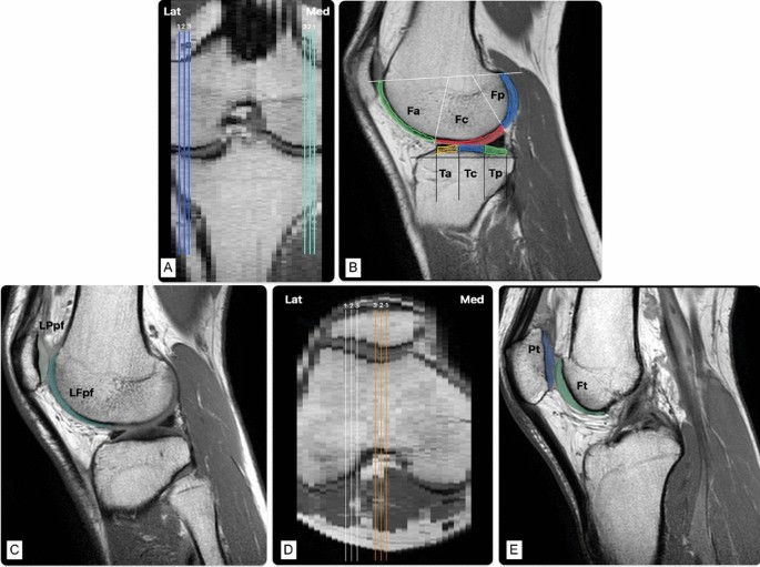 Detection of physiological changes in knee cartilage using parametric ...