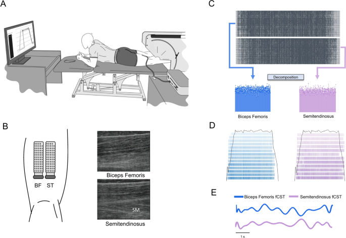 Independent neural drives and distinct motor unit discharge ...