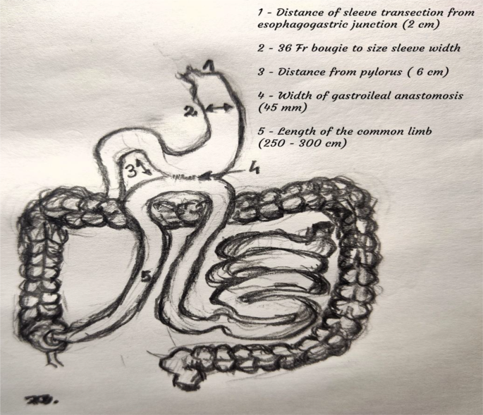 Anemia and iron metabolism disorders after single anastomosis sleeve ...