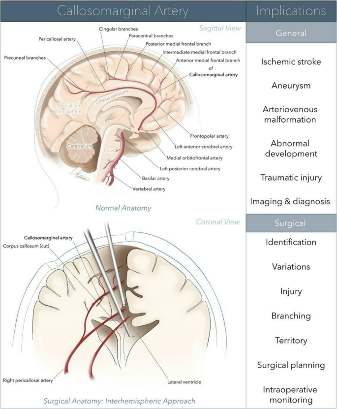 Callosomarginal artery: an in-depth of anatomical characteristics ...