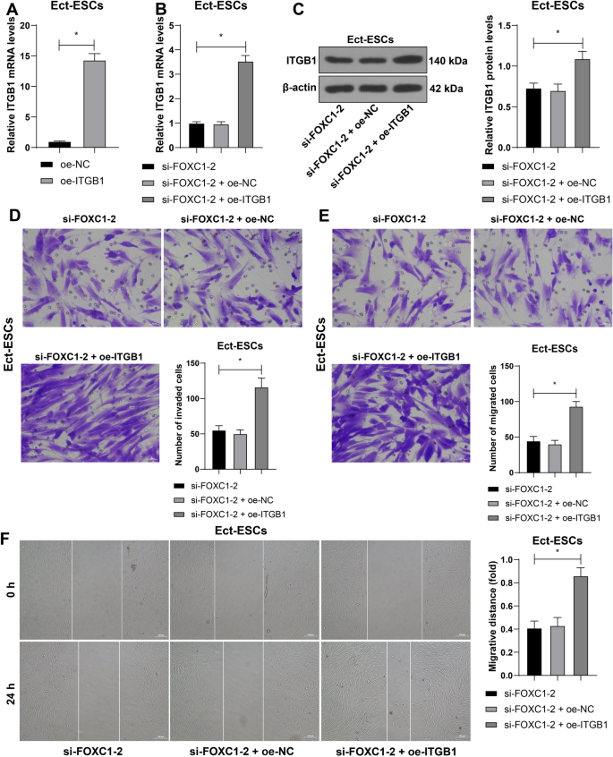 Mechanism of FOXC1 in the invasion and migration of ectopic endometrial ...