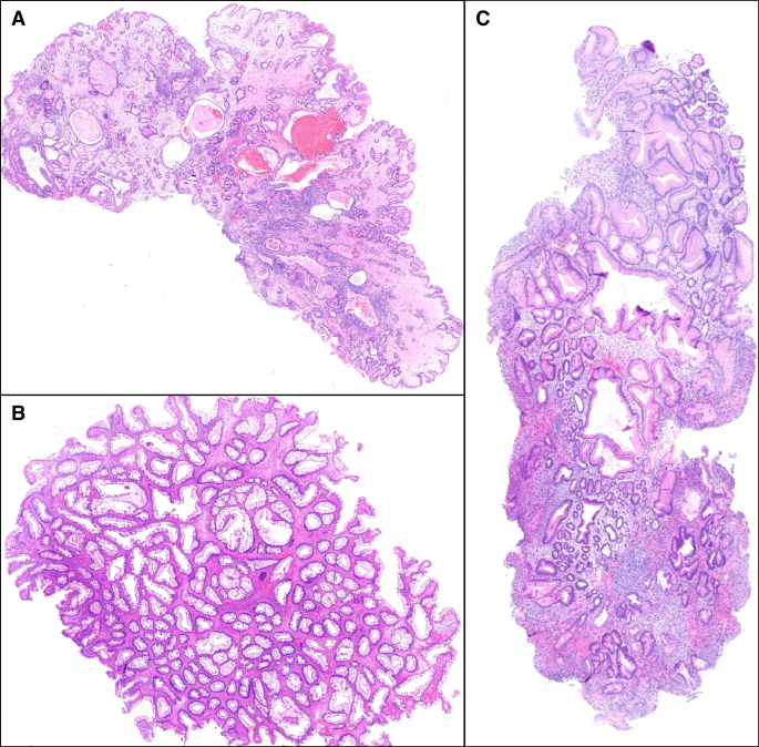 Screening at the scope: enhancing the role of pathologists in ...