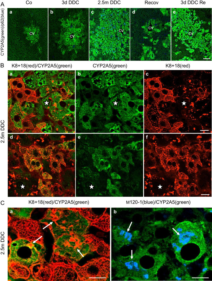 Cytochrome P450 as possible link between Mallory-Denk body formation in ...