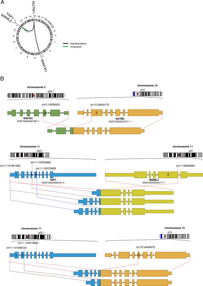 Skin-analogue primary poroid neoplasms of the head and neck with YAP1 ...