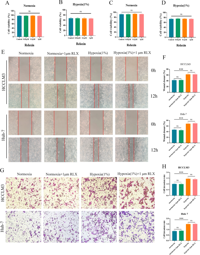 Relaxin combined with transarterial chemoembolization achieved ...