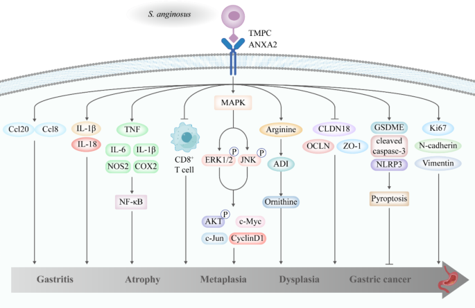 Streptococcus anginosus: the potential role in the progression of ...