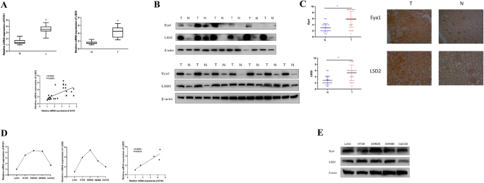 EYA1 promotes tumor angiogenesis in colorectal cancer by activating HIF ...