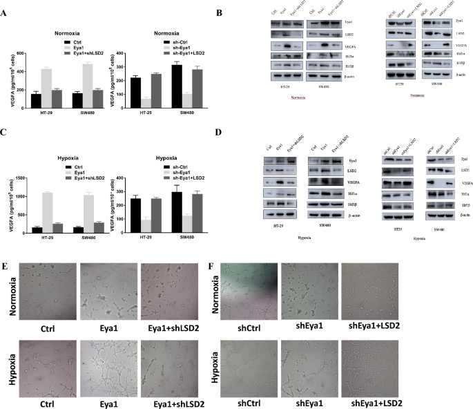 EYA1 promotes tumor angiogenesis in colorectal cancer by activating HIF ...