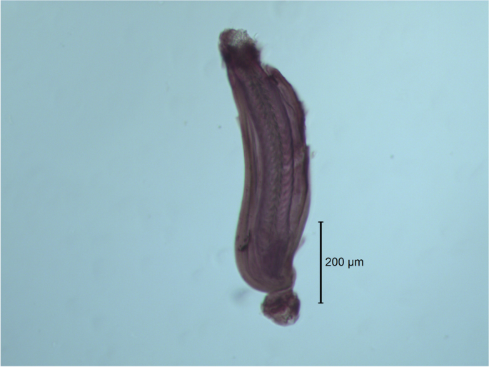 Subcutaneous occurrence of encysted Acanthocephala in an anuran ...