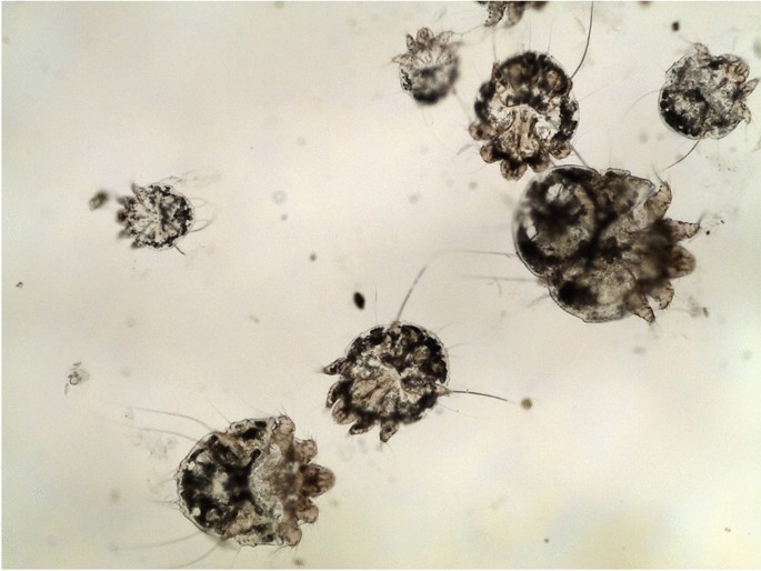 Scabies vaccines: where we stand and challenges ahead | Parasitology ...