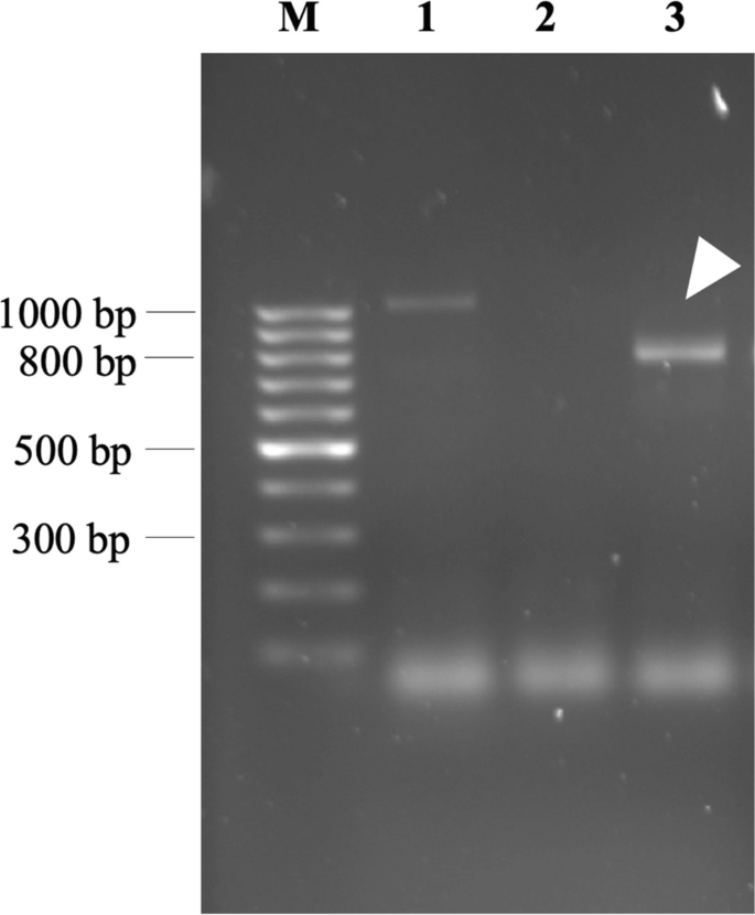 Vermamoeba vermiformis as the etiological agent in a patient with suspected non-Acanthamoeba ...