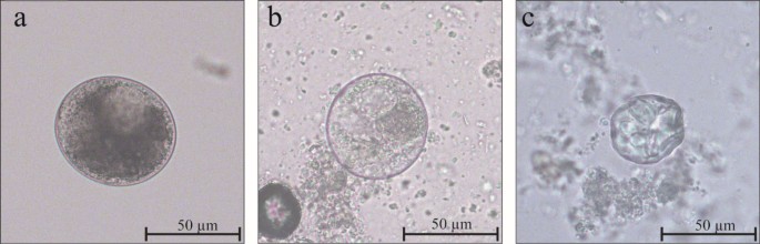 Prevalence and molecular characterisation of Balantioides coli in pigs ...