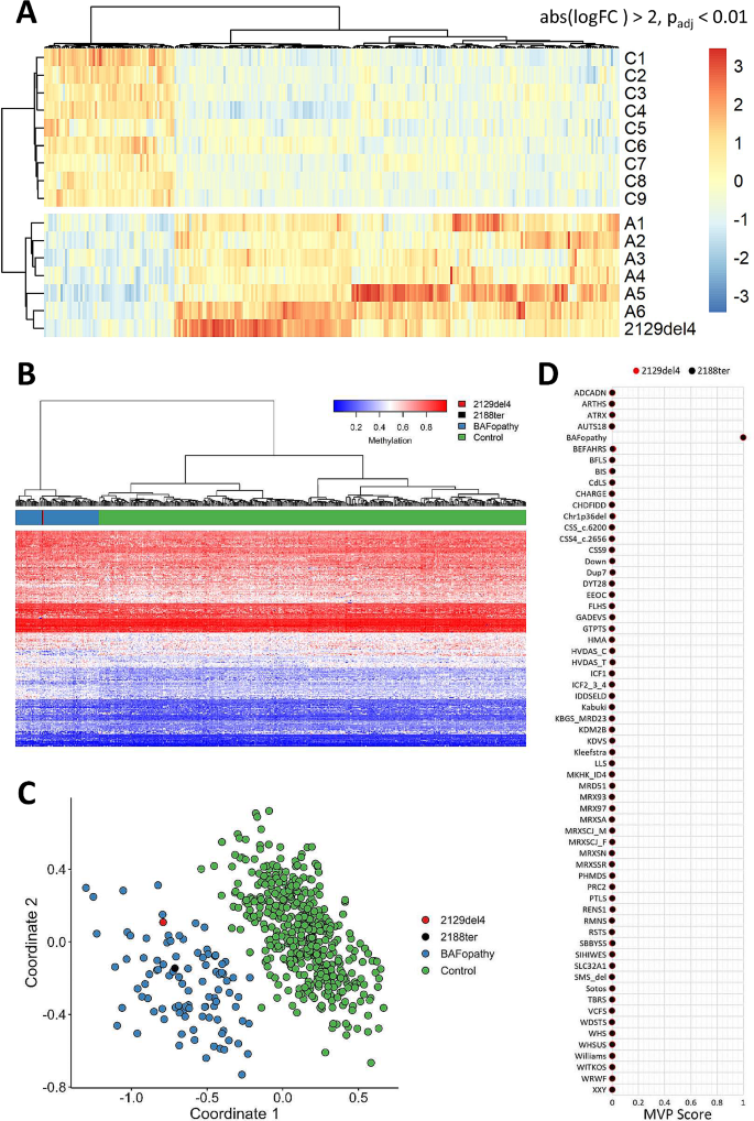 The missing link: ARID1B non-truncating variants causing Coffin-Siris ...