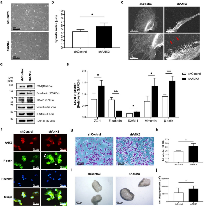 Downregulation of ankyrin 3 (ANK3) promotes malignant behaviors ...