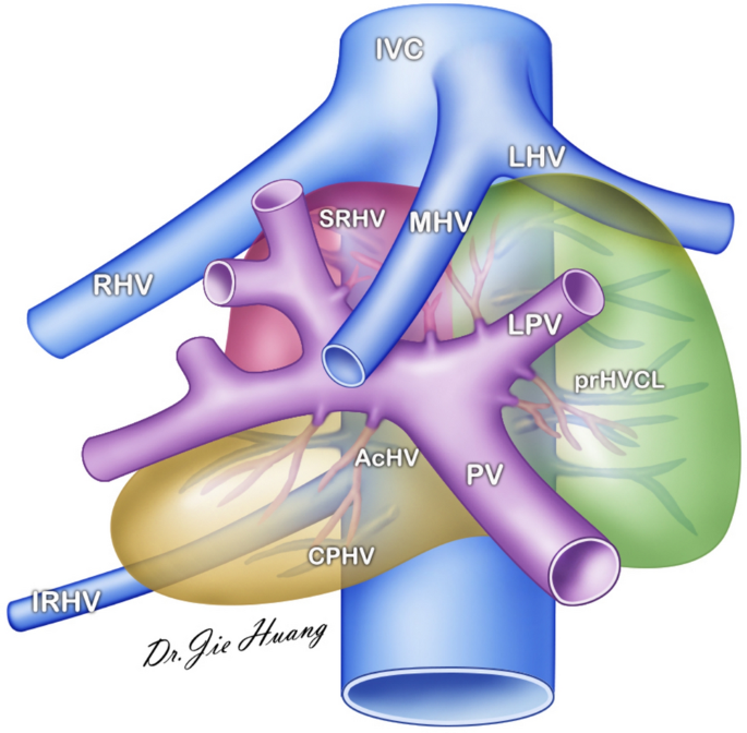 Laparoscopic caudate lobe resections: How I do it: tips and pitfalls ...