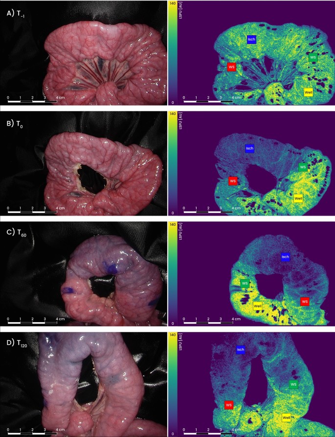 Real-time quantification of laser speckle contrast imaging during ...