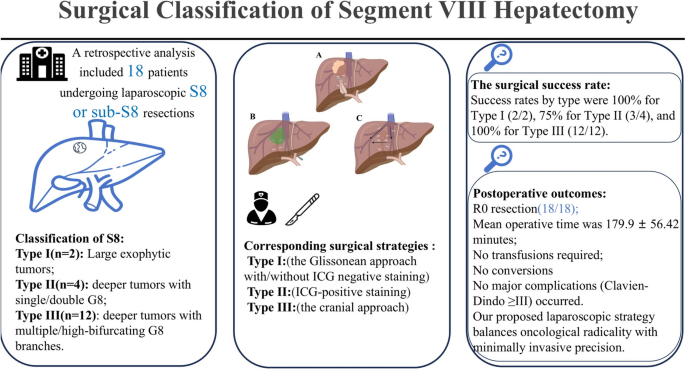 Surgical classification of segment VIII: an anatomical model guiding ...
