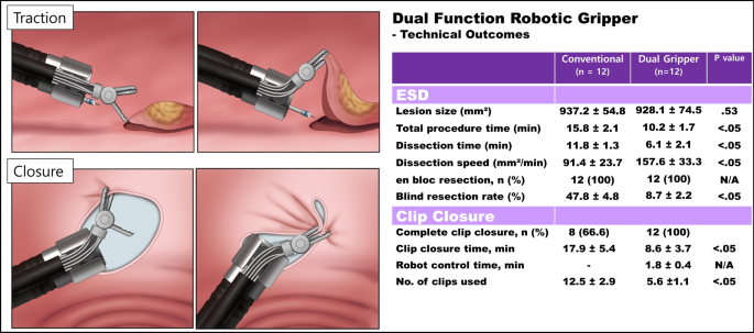 Dual-function robotic gripper for traction and closure in gastric ...