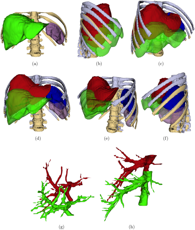 Morphological changes on the human liver during minimally invasive ...