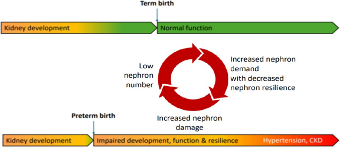 Preserving nephron number in children after preterm birth: a top ...