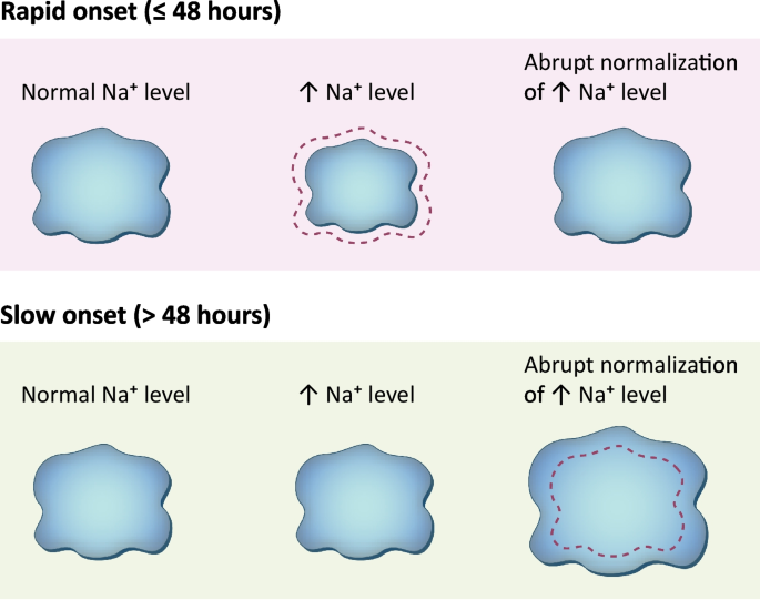 Thirst, sodium, and the hospitalized child: rethinking hypernatremia ...