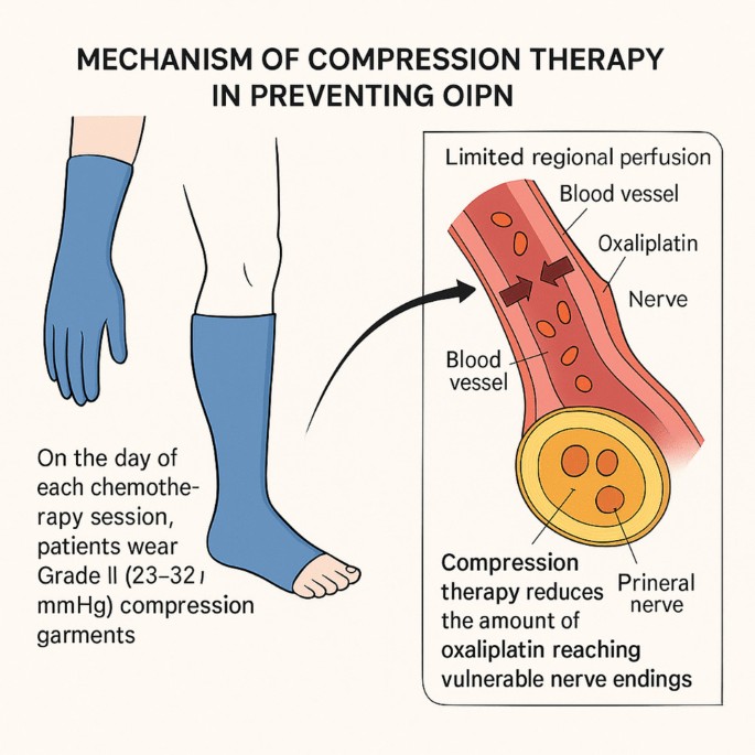 Clinical efficacy of compression therapy in preventing oxaliplatin ...