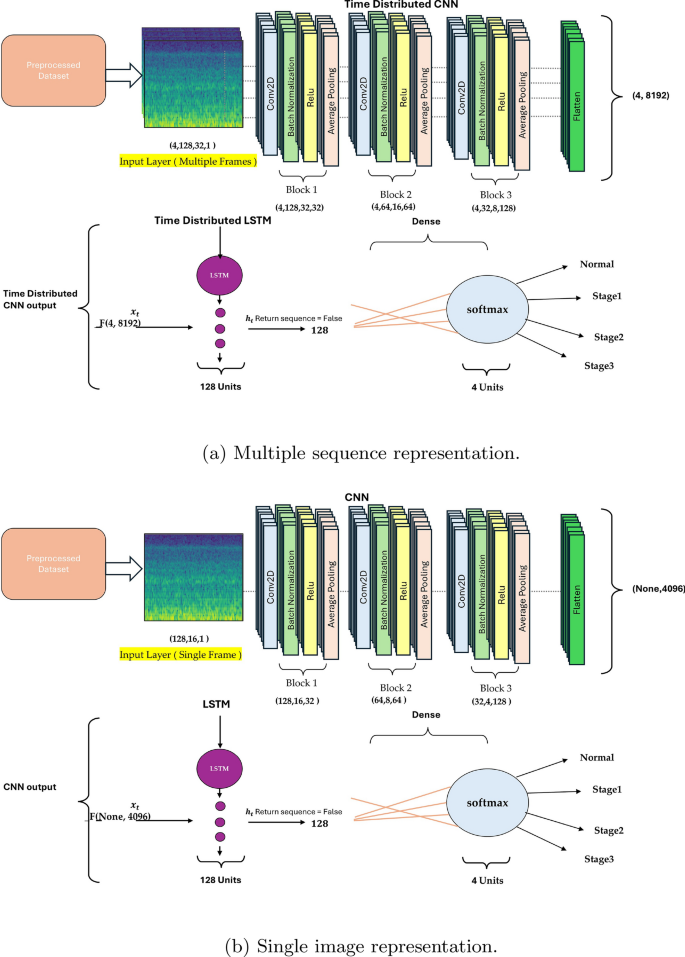 TD-CLNet: a time-distributed CNN-LSTM network for fault detection in belt conveyor idlers ...