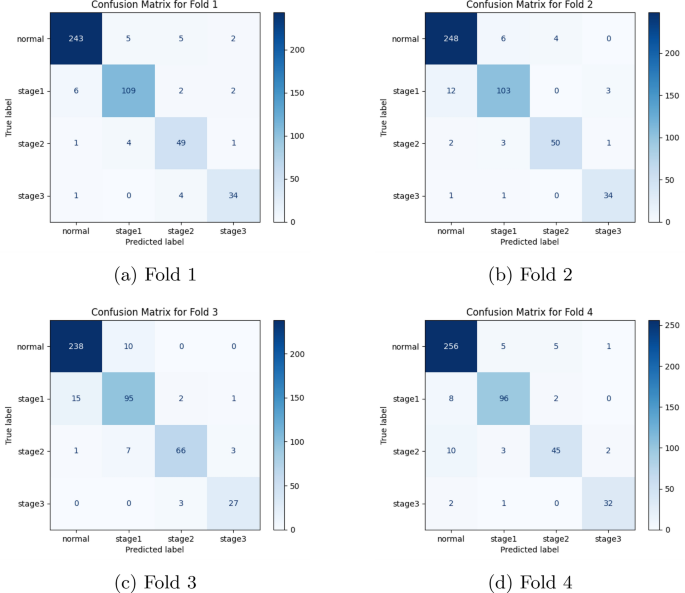 TD-CLNet: a time-distributed CNN-LSTM network for fault detection in ...