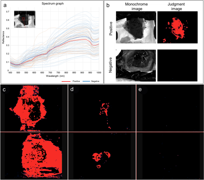 Possibility of determining high quantitative fecal occult blood on ...