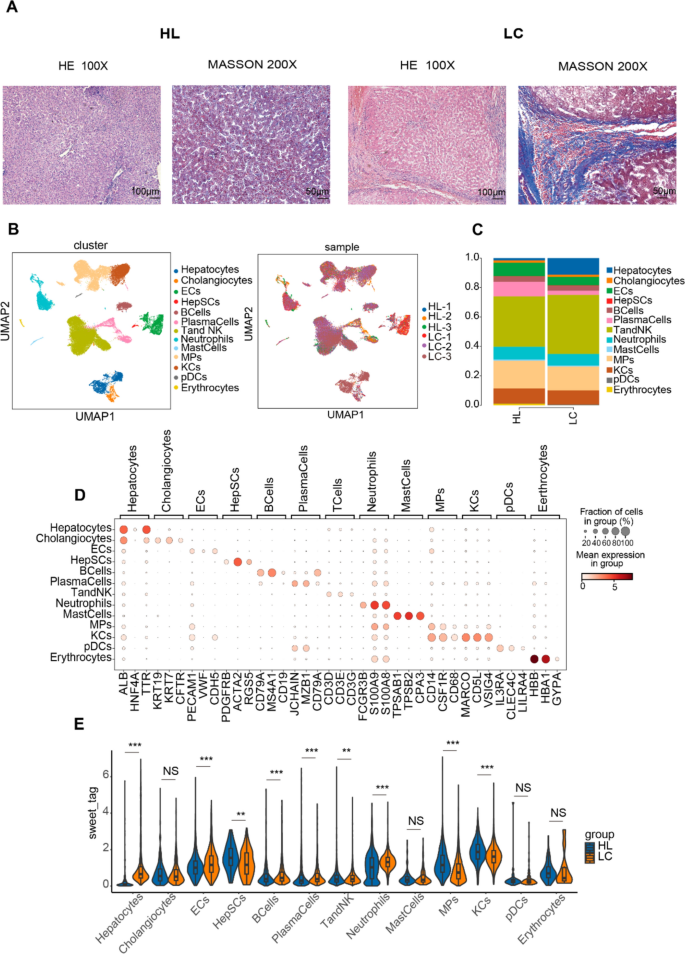 Single-cell RNA sequencing and functional analysis reveal the role of ...