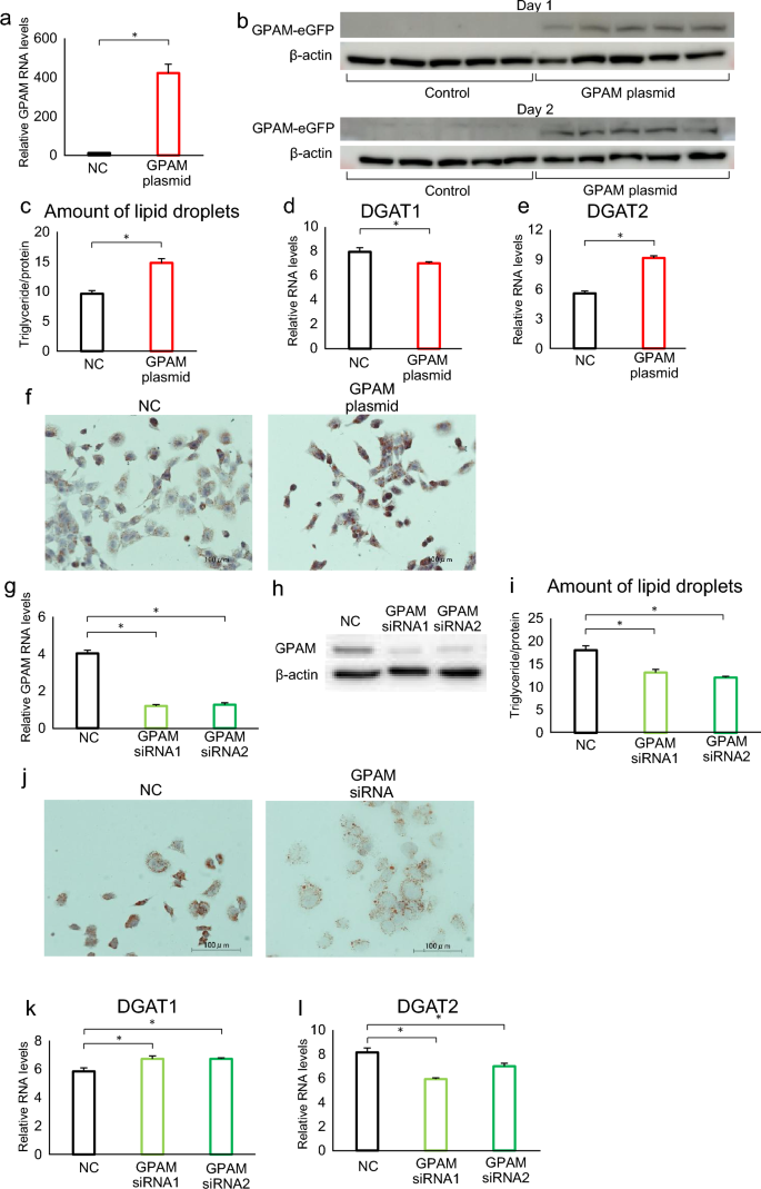 GPAM upregulation enhances hepatic fat deposition and reduces visceral ...