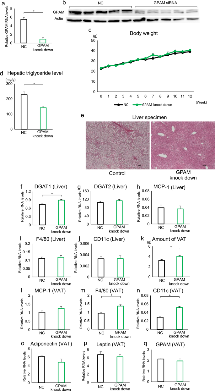 GPAM upregulation enhances hepatic fat deposition and reduces visceral ...