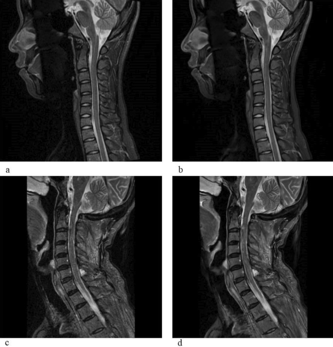 Assessment of image quality and diagnostic accuracy for cervical ...