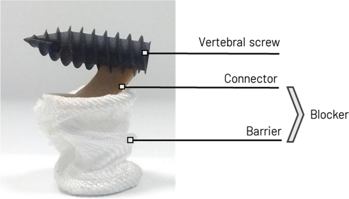 A new hernia blocking system to prevent recurrent lumbar disc ...