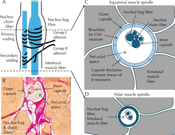 ISSLS Prize in Basic Science 2025: Structural changes of muscle ...