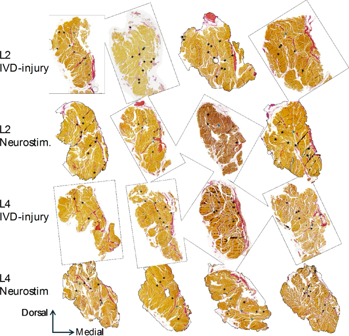 ISSLS Prize in Basic Science 2025: Structural changes of muscle ...
