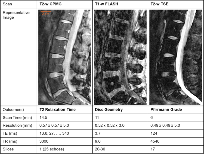 Effective disc age: a statistical model for age-dependent and level ...