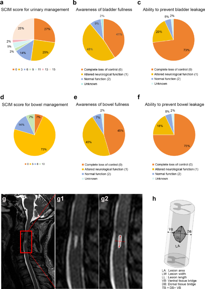 Tissue bridges offer valuable insights into bladder and bowel outcomes ...