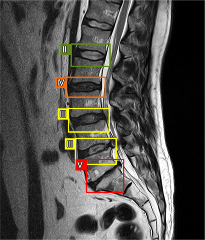 Lumbar Spine Mri Interpretation Take Home Points In Imaging
