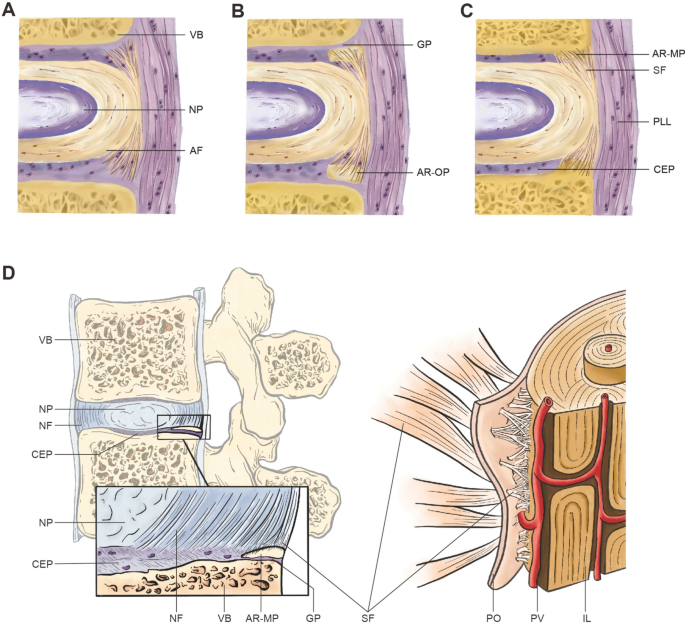 Association of delayed apophyseal ring maturation with juvenile lumbar ...