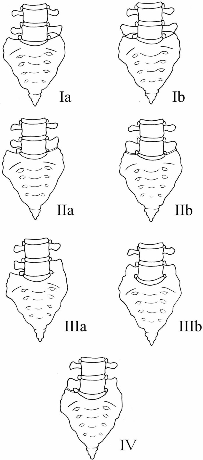 Pediatric lumbar spine MRI: structural imaging findings and anatomical ...