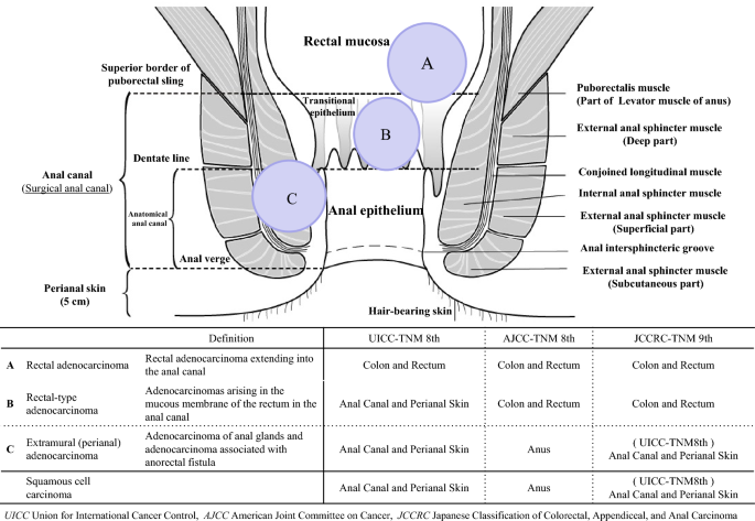 The inguinal lymph nodes as regional lymph nodes in anal canal adenocarcinomas: a nationwide ...