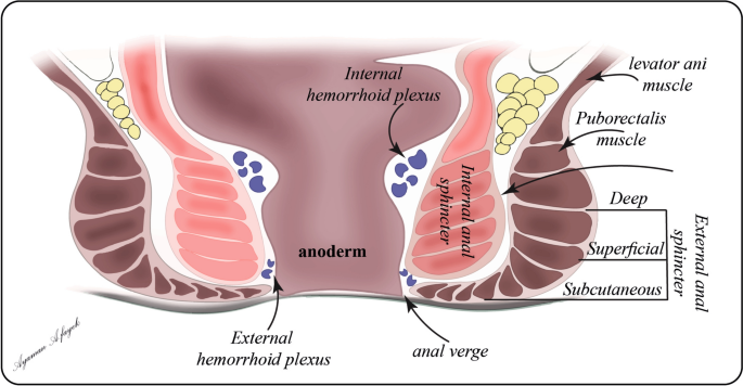 Understanding the anatomical basis of anorectal fistulas and their ...
