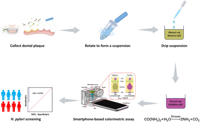 Smartphone-based colorimetric detection of urease activity in dental ...