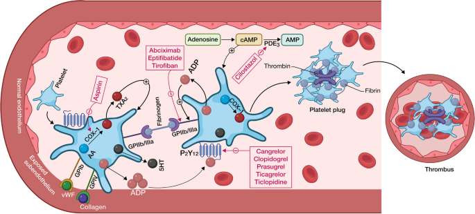 Variability patterns in dual antiplatelet therapy following ...