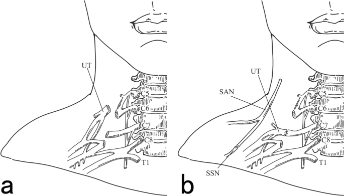 The prerequisites and clinical outcomes of ipsilateral C7 nerve root ...