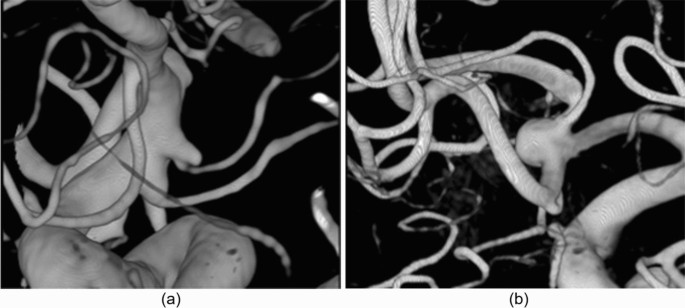 Comparison between ruptured anterior choroidal artery aneurysms and ...
