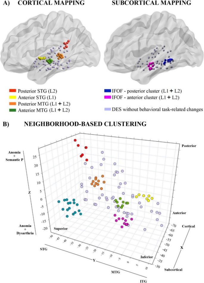 Transient selective aphasia in highly proficient bilinguals triggered by electrical stimulation ...