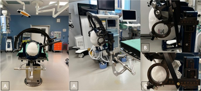Technical aspects of SEEG limitations and solutions using the Leksell ...
